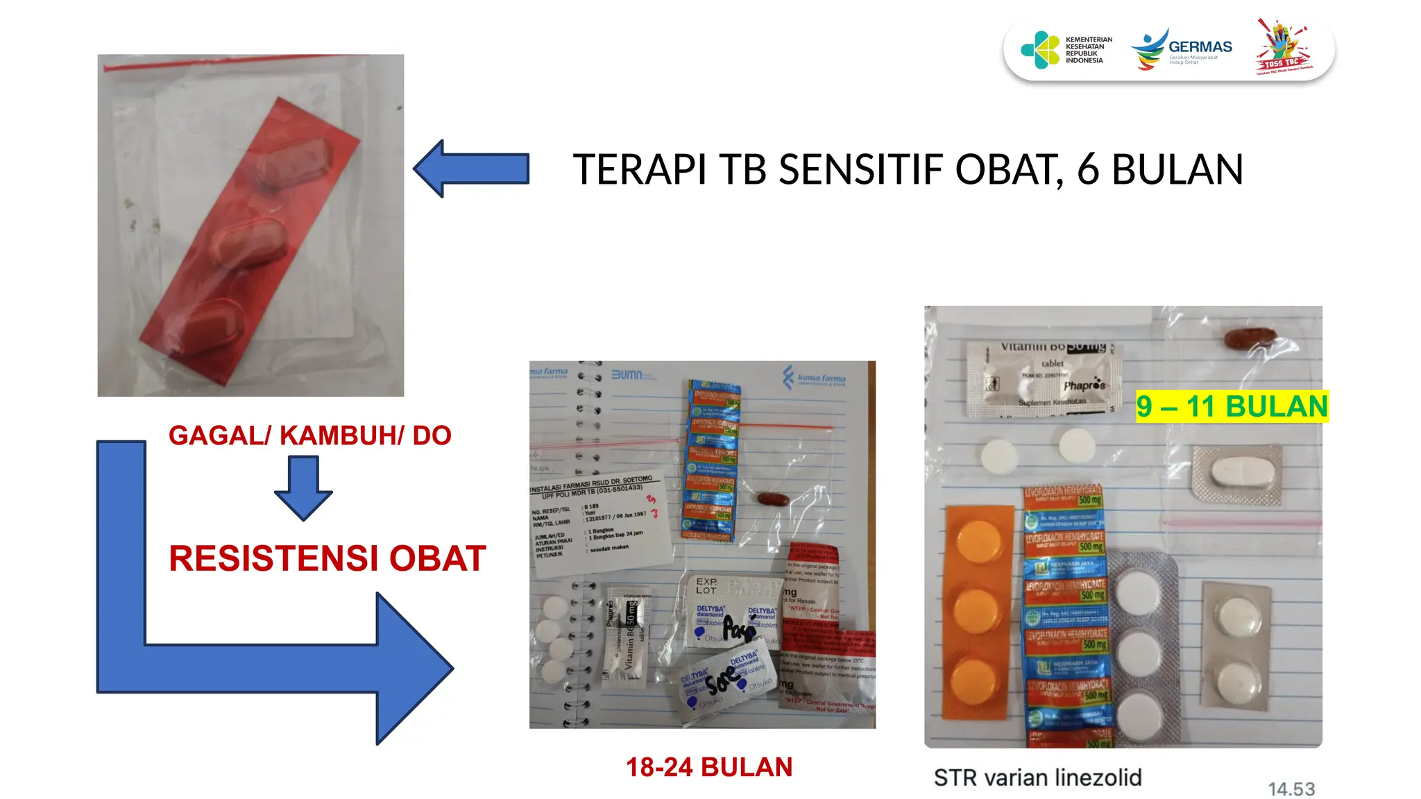Diagnosa da tata laksana Tuberkulosis .pptx