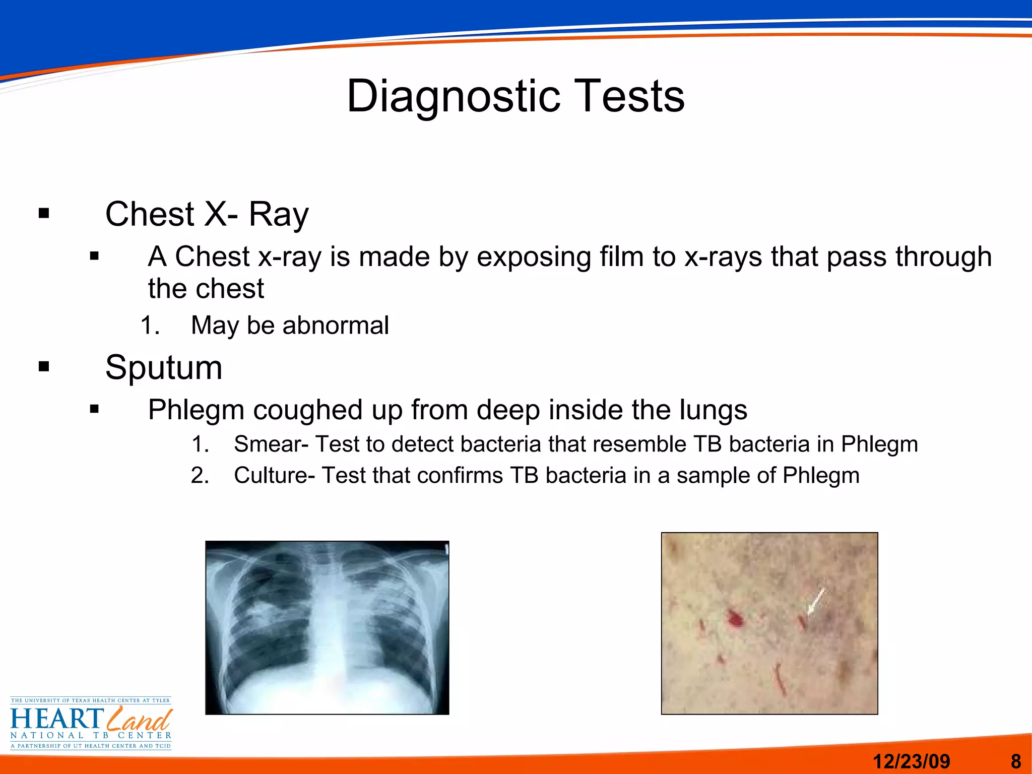 TB Terminology | PPT