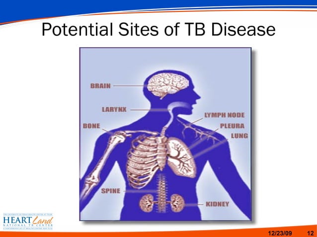 TB Terminology | PPT