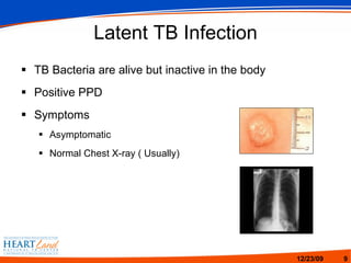 TB Terminology | PPT