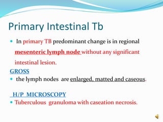 Tb,typhoid | PPTX