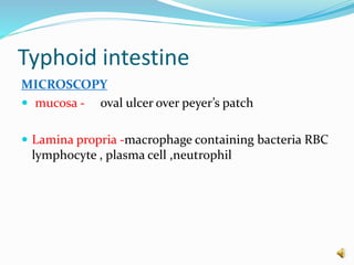 tbtyphoid-200519073256 (1).pdf