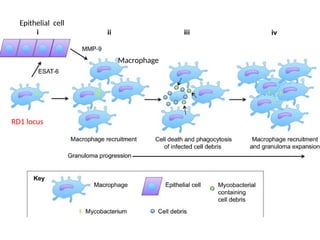 Tuberculosis verrucosa cutis a skin condition | PPTX