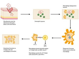 Tuberculosis verrucosa cutis a skin condition | PPTX
