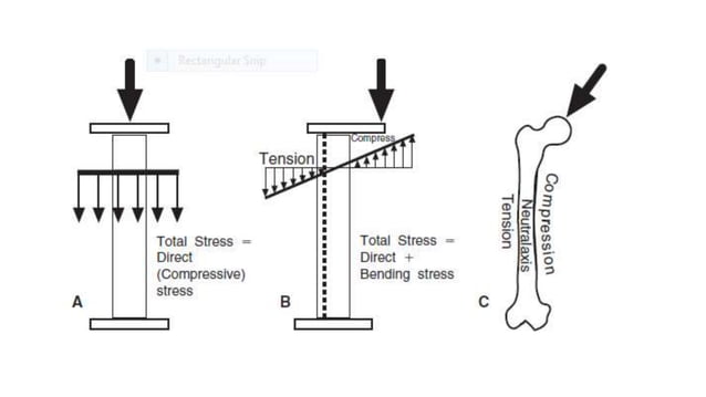 Tension Band Wiring principles and applications | PPTX