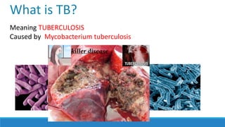 TB_you take my breath away. Things to know about TB. | PPT