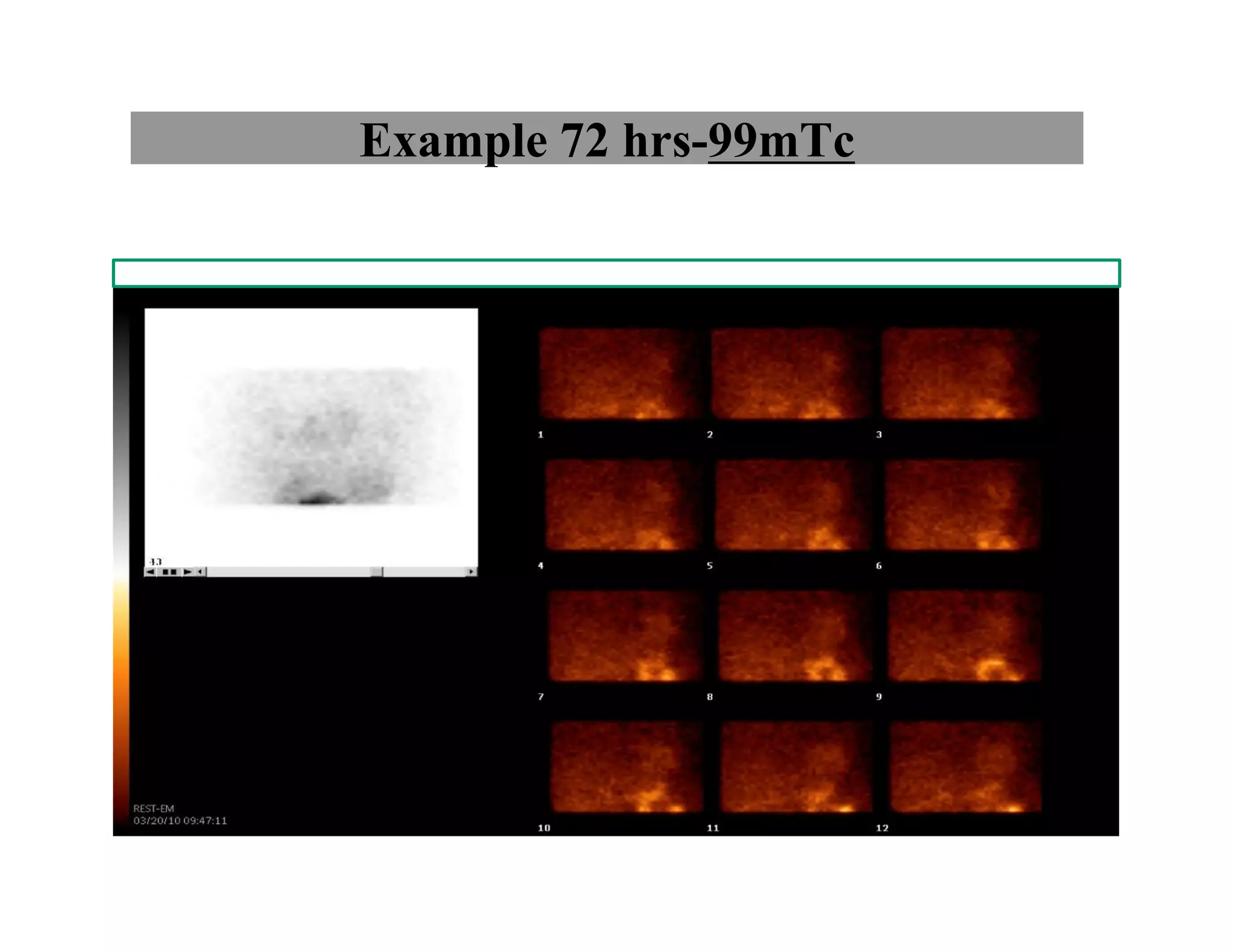Practical Aspect of Tc 99m radiopharmaceuticals | PDF