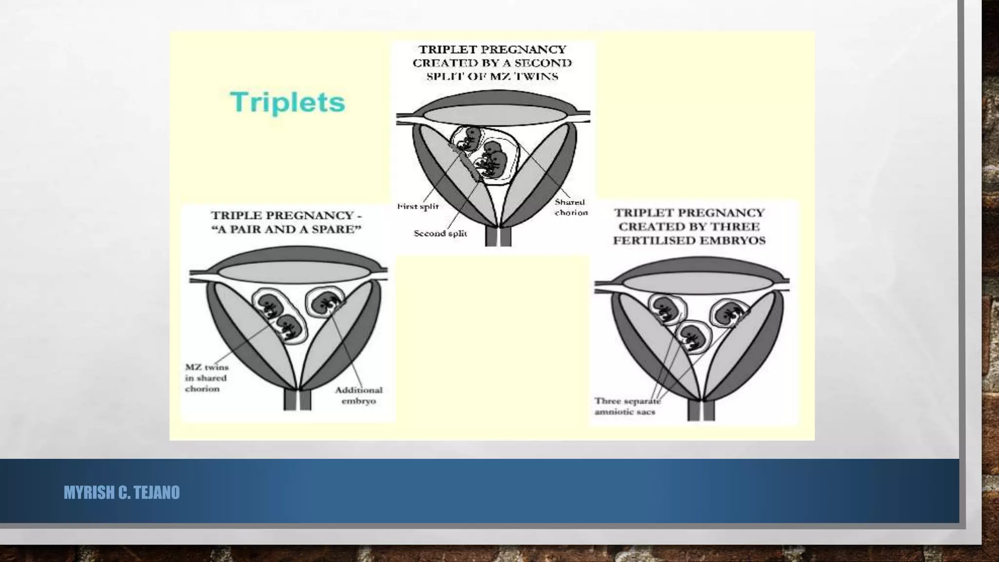 Twins, Triplets and Quintuplets | PPTX