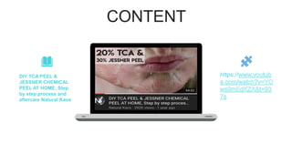 20% Tca peel | PPT | Free Download