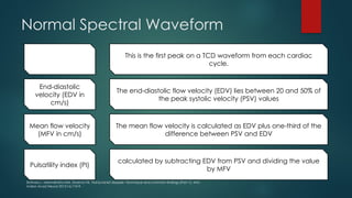 Doppler VS Duplex Sonography, Normal Mean Velocities, Directions ...