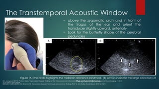 Doppler VS Duplex Sonography, Normal Mean Velocities, Directions ...