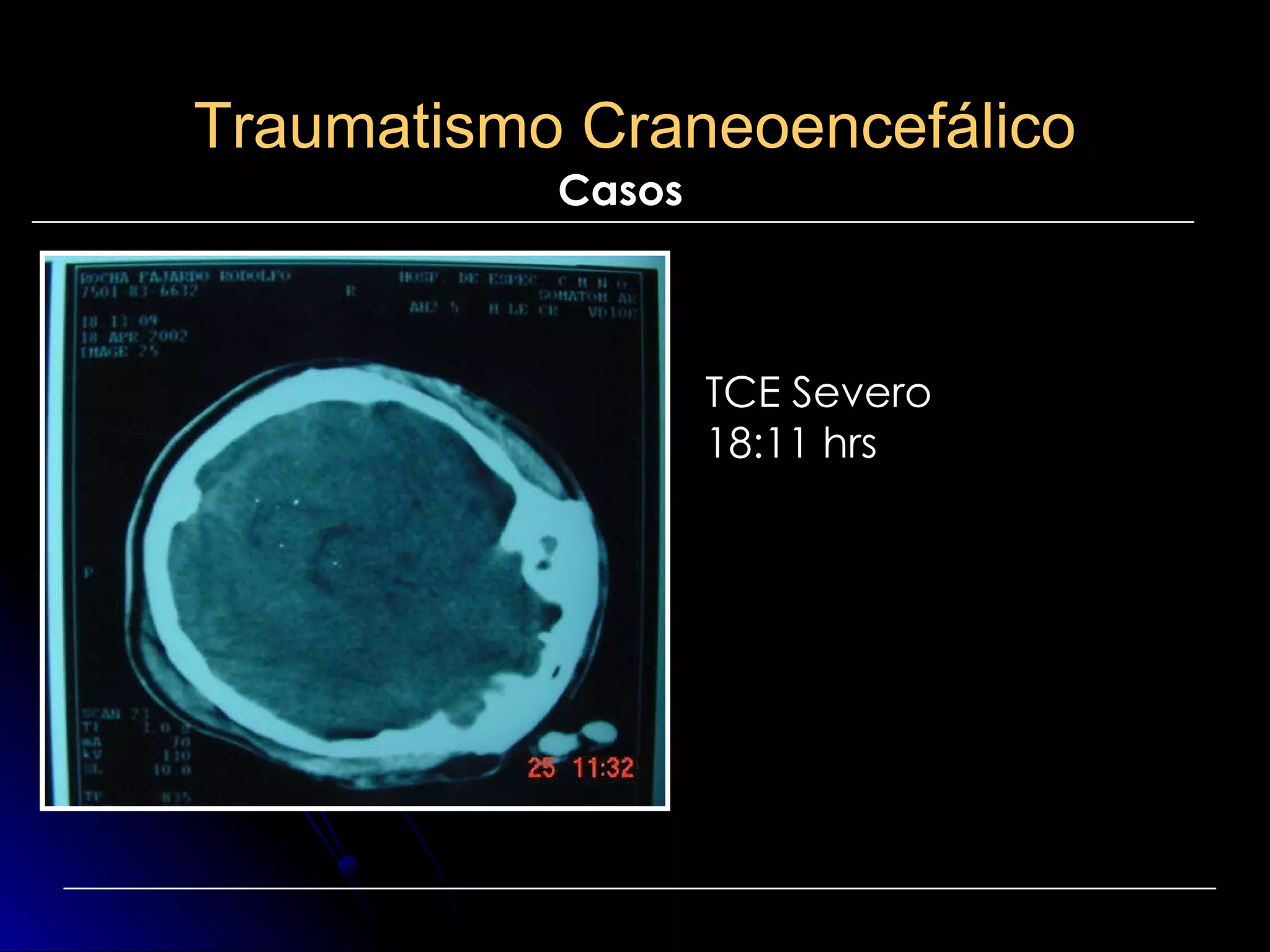 traumatismo craneo encefalico | PPT