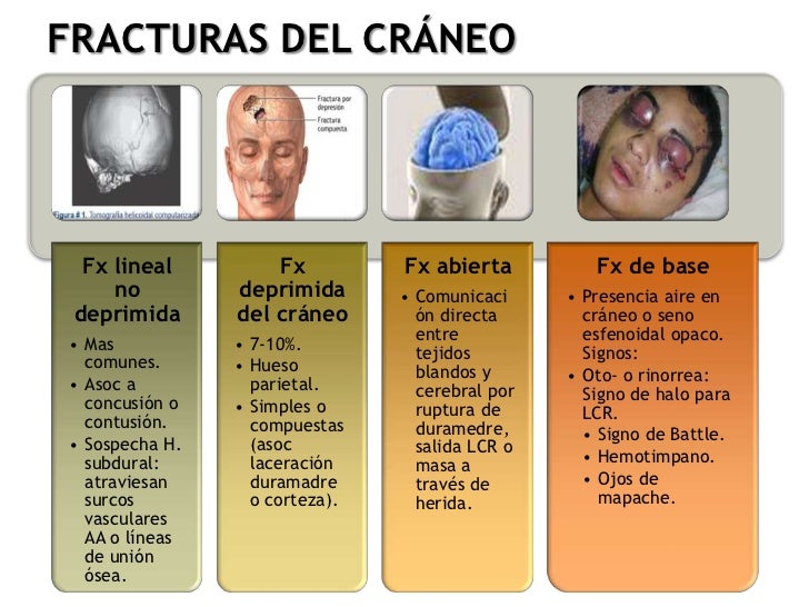 Trauma Craneo Encefalico TCE