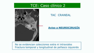 Manejo del TCE en pediatría (por Mª Teresa Fernández Castaño) | PPTX