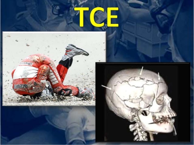 TCE. Traumatismo craneoencefálico, diagnóstico y tratamiento.