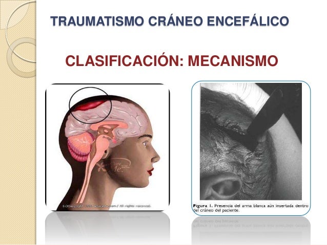MANEJO DEL TRAUMA CRANEOENCEFALICO EN HOSPITAL BASICO