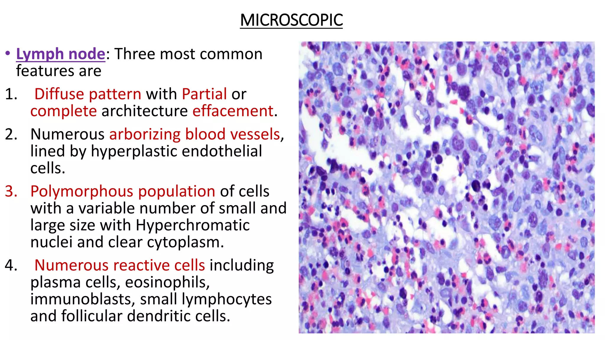 T cell lymphomas - By Dr MULUKALA SWETHA | PPTX