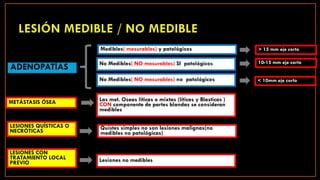 Importancia de la Técnica TC en el uso del RECIST 1.1 | PPT
