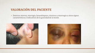 Traumatismo craneoencefálico en pediatría | PPTX