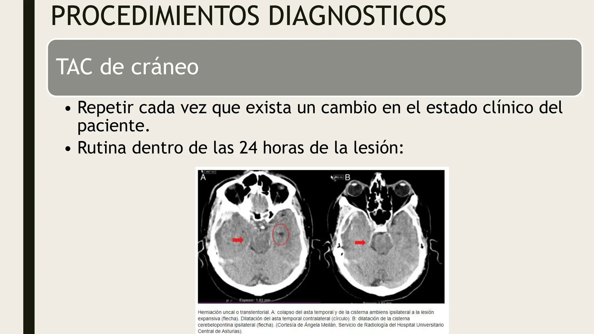 traumatismo craneo encefalico en unidad de cuidados intensivos | PPTX