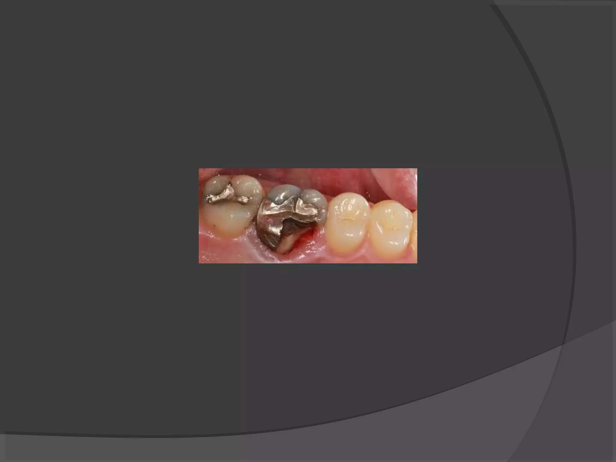 Introduction to Dentistry 4 | PPT