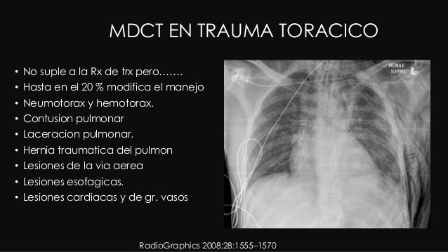 Tcmd FM 55-17 Chapter 8 Loading and Discharging Cargo Vessels