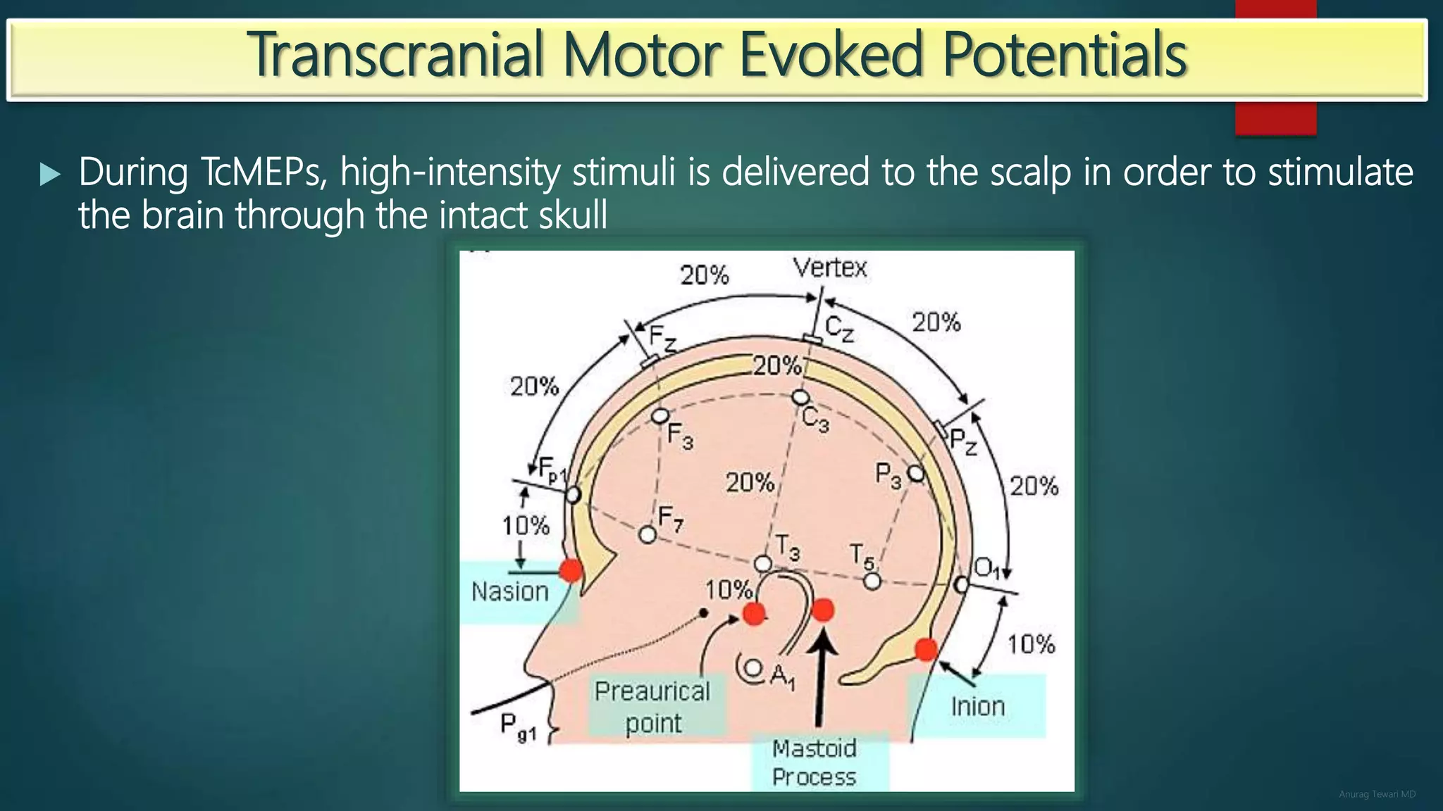 Transcranial Motor Evoked Potentials Monitoring per aACNS guidelines | PPTX