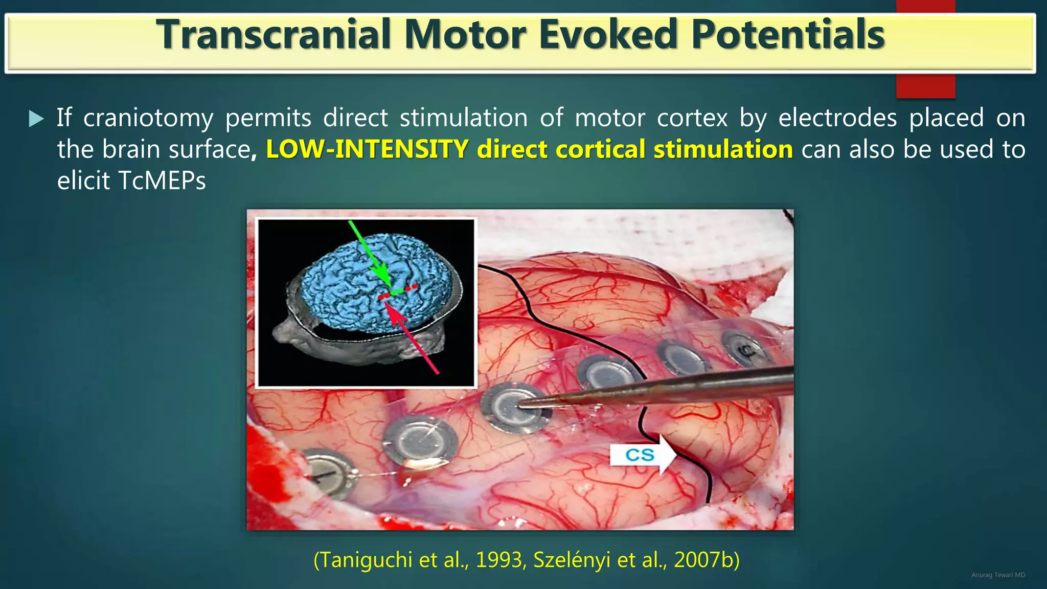 Transcranial Motor Evoked Potentials Monitoring per aACNS guidelines | PPTX