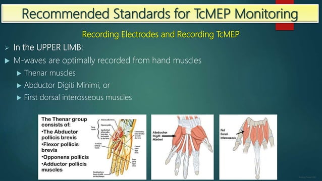 Transcranial Motor Evoked Potentials Monitoring per aACNS guidelines | PPTX