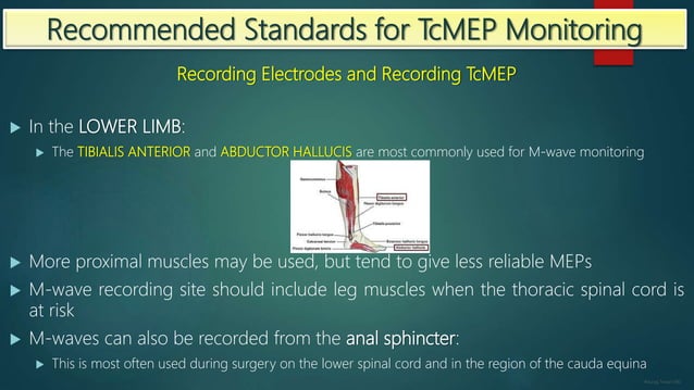 Transcranial Motor Evoked Potentials Monitoring per aACNS guidelines | PPTX