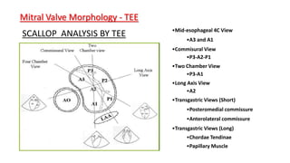 Transcatheter therapy for Mitral Regurgitation (MR) | PPTX