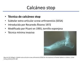 Técnica de calcaneo stop vs endortesis en el pie plano infantil | PDF