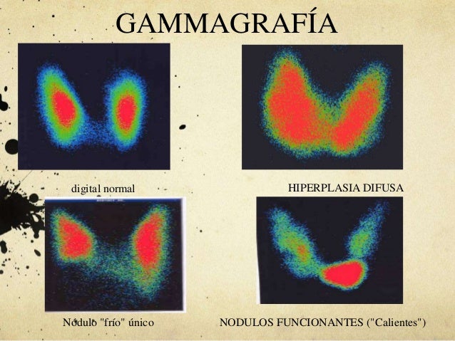 Tiroides. Pruebas funcionales y radiológicas.