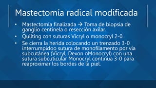 Técnica quirúrgica en mastectomía.pptx