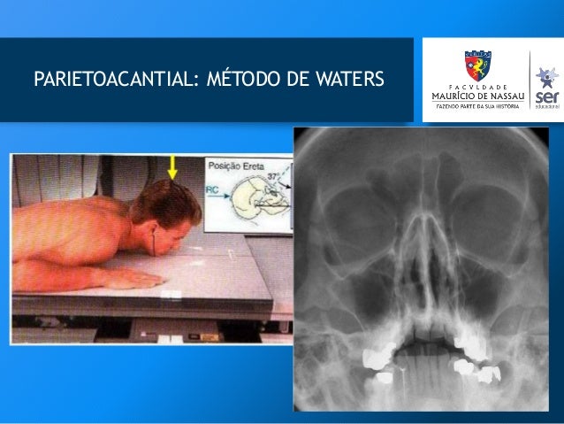 Técnicas cabeça e pescoço