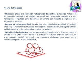 Técnicas de fusión intersomática | PPT