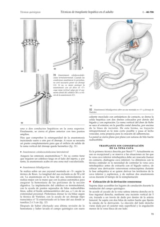 Técnicas Quirurgicas de Trasplante Hepático en el Adulto | PDF