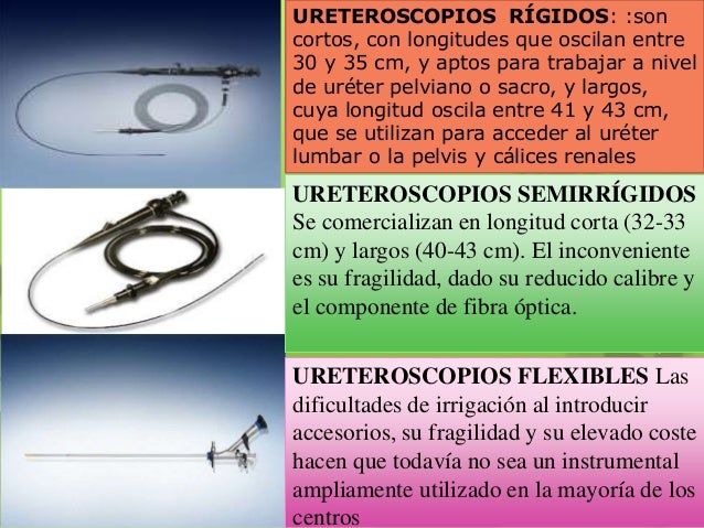 Técnicas endoscópicas en urología