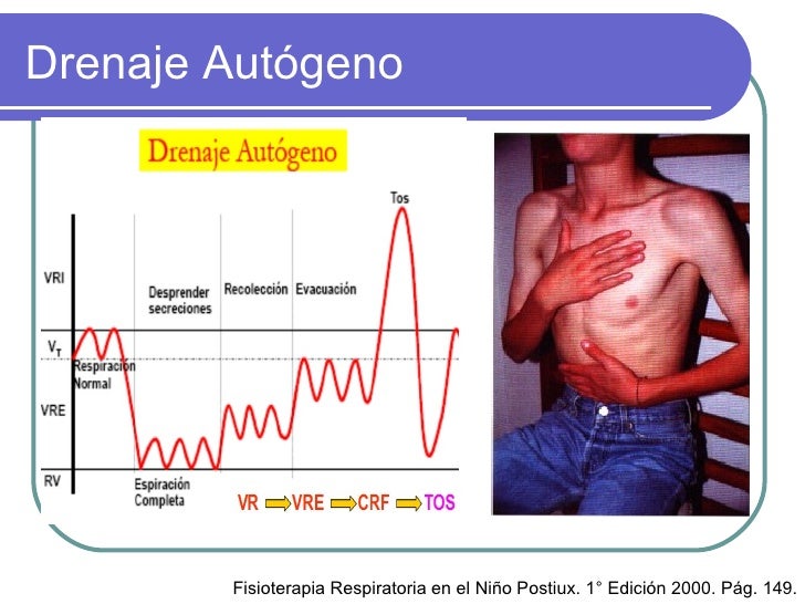 Técnicas kinésicas respiratorias