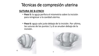 TÉCNICAS QUIRÚRGICAS CONSERVADORAS.pptx
