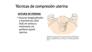 TÉCNICAS QUIRÚRGICAS CONSERVADORAS.pptx