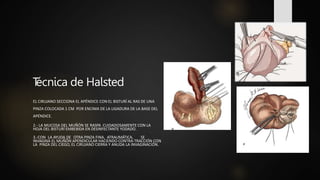 TÉCNICAS QUIRÚRGICAS PARA EL MANEJO DEL MUÑÓN APENDICULAR.ppsx