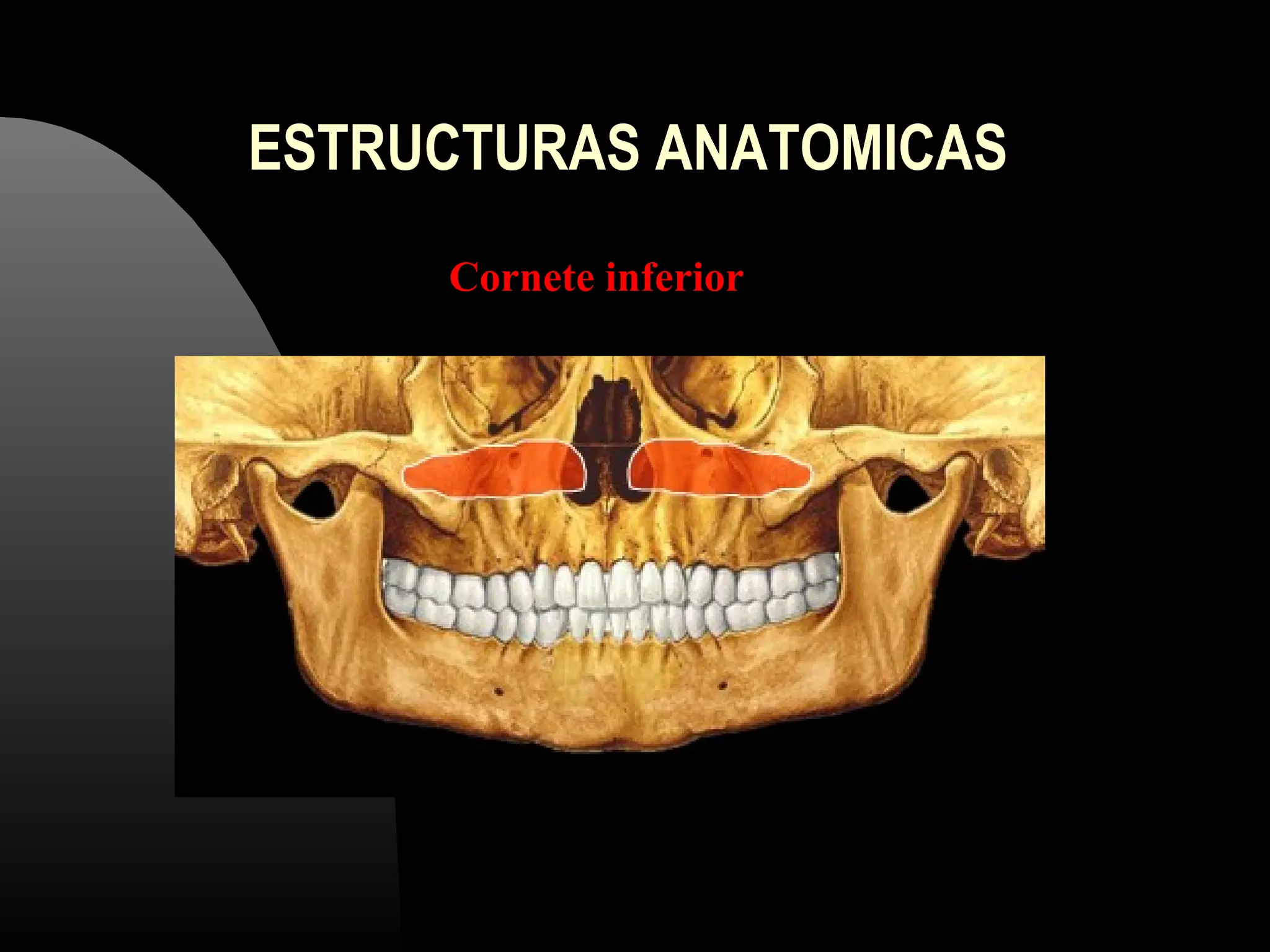 técnicas radiografías panoramicas aplicadas en odontologia | PDF | Bone ...