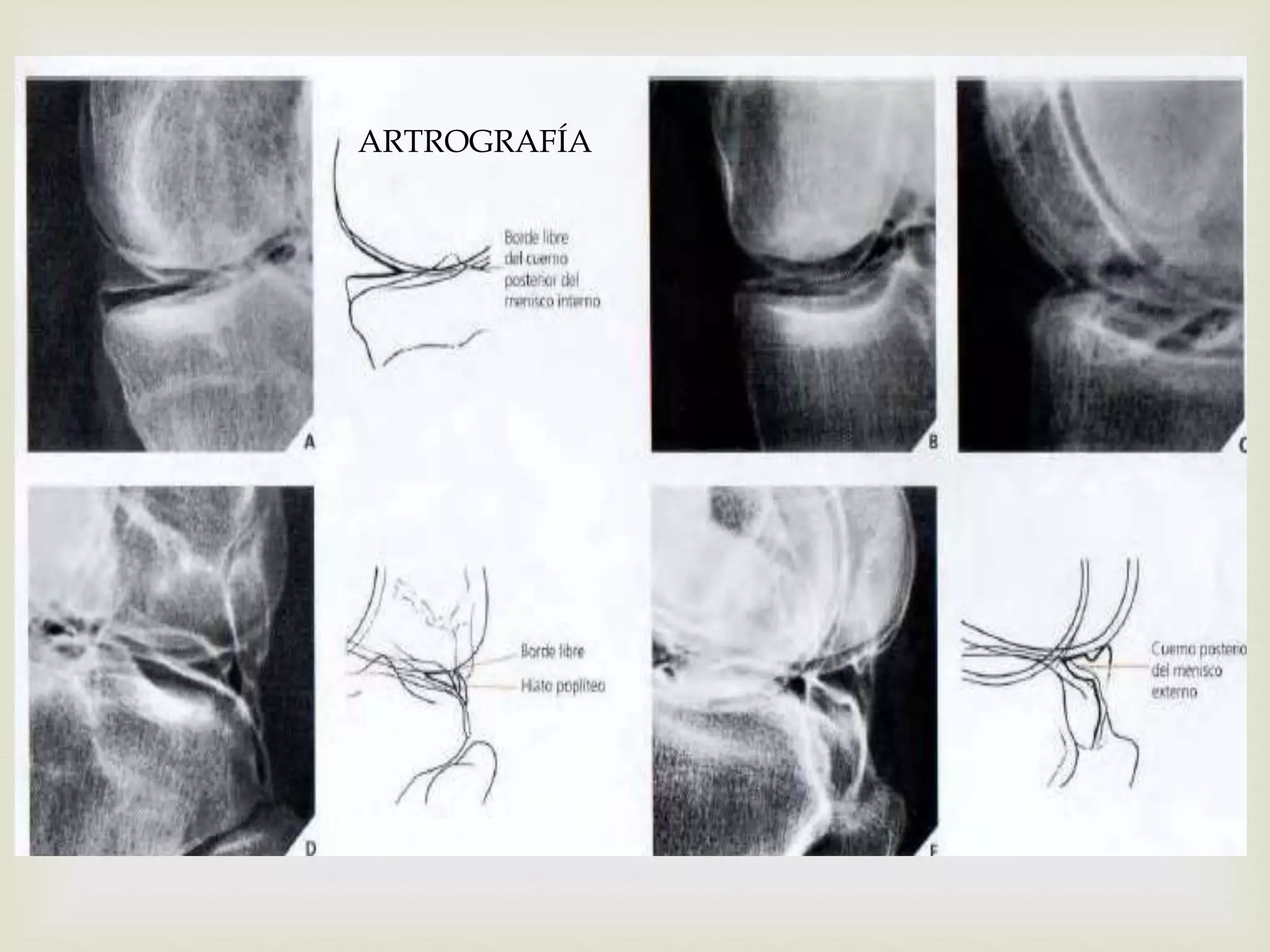 Técnicas y proyecciones muslo y rodilla | PPTX