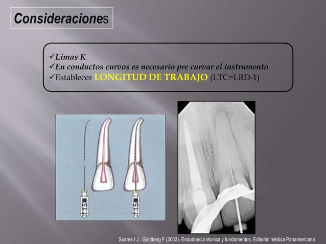 Técnica telescópica o step back