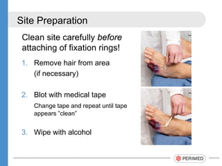 Tcpo2 site selection | PDF