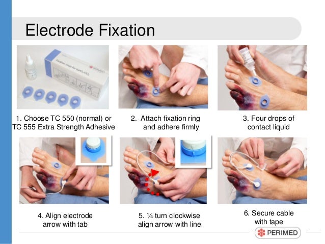 Tcpo2 site selection