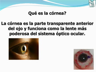 TRASPLANTE DE CORNEA | PPT