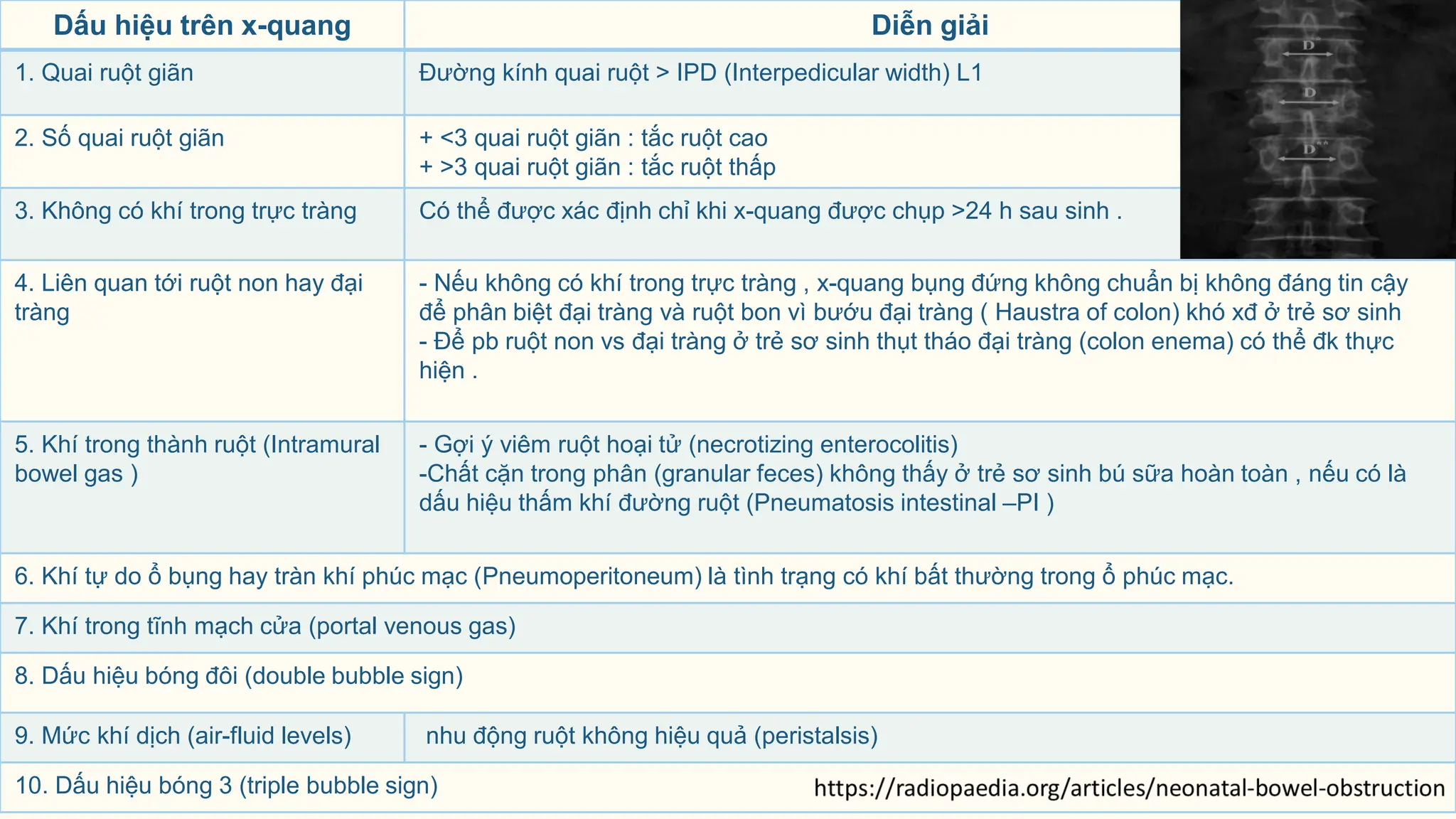 TRÌNH CHUYÊN ĐỀ TẮC RUỘT SƠ SINH NTH.pdf