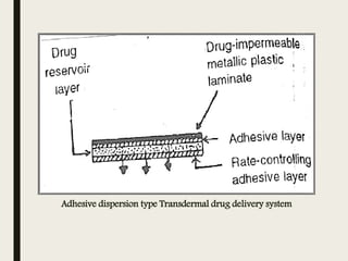 Transdermal Drug Delivery System | PPTX | Skin and Dermatology ...
